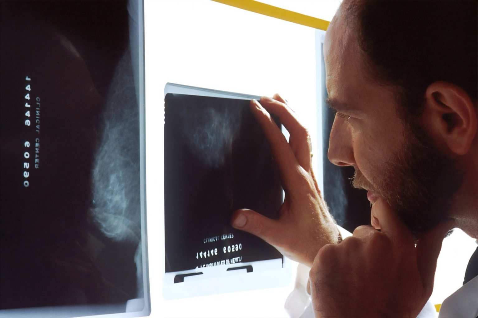 The Role of Image Recognition AI in Medicine - SentiSight.ai